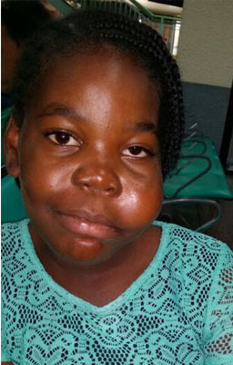 SKNVibes | Bank account opens for donations to assist Vernel Thomas